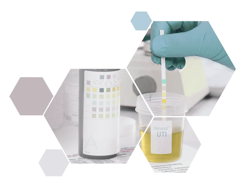 UTI Testing | Infectious Disease Testing