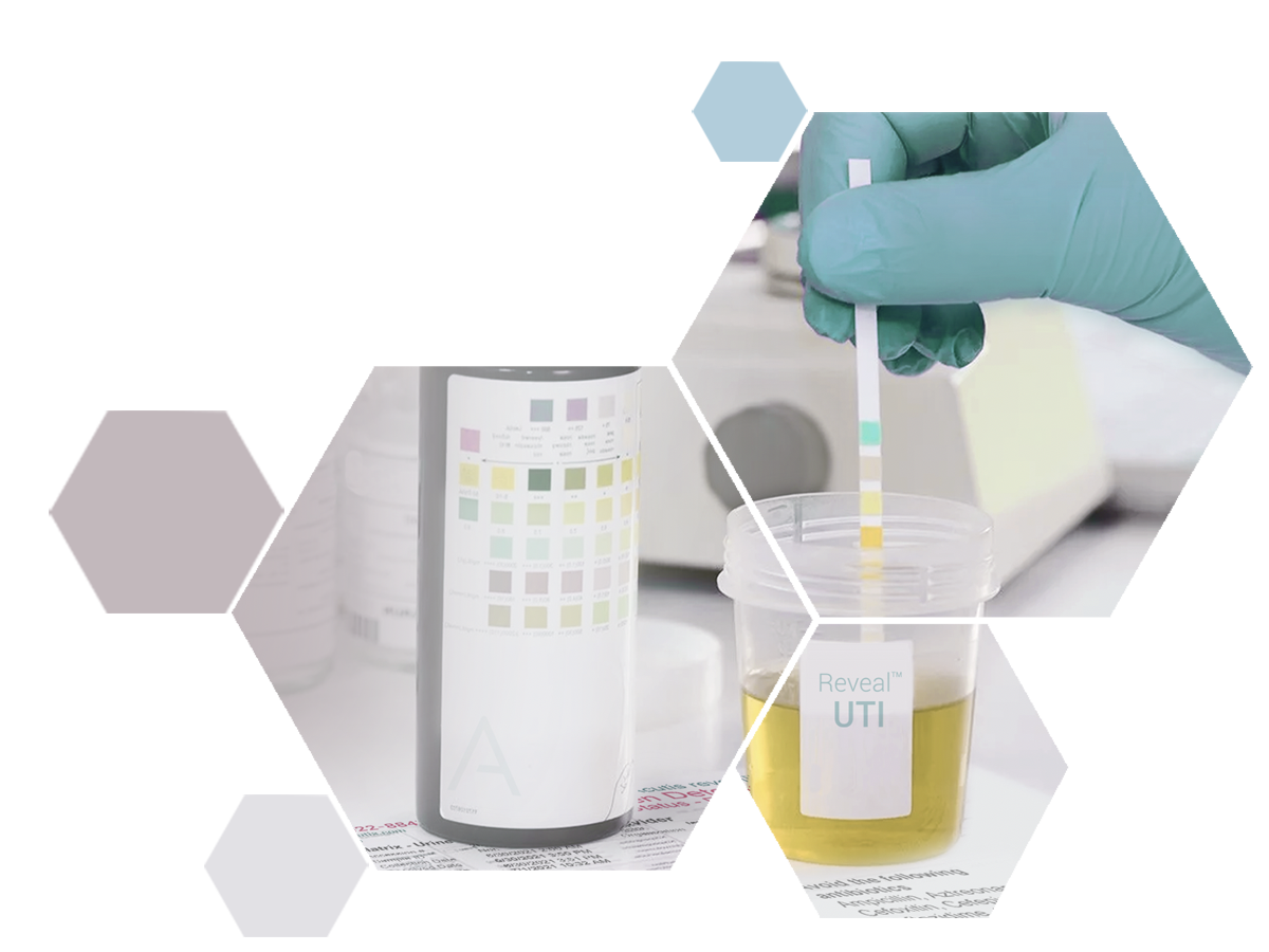 UTI Testing | Infectious Disease Testing
