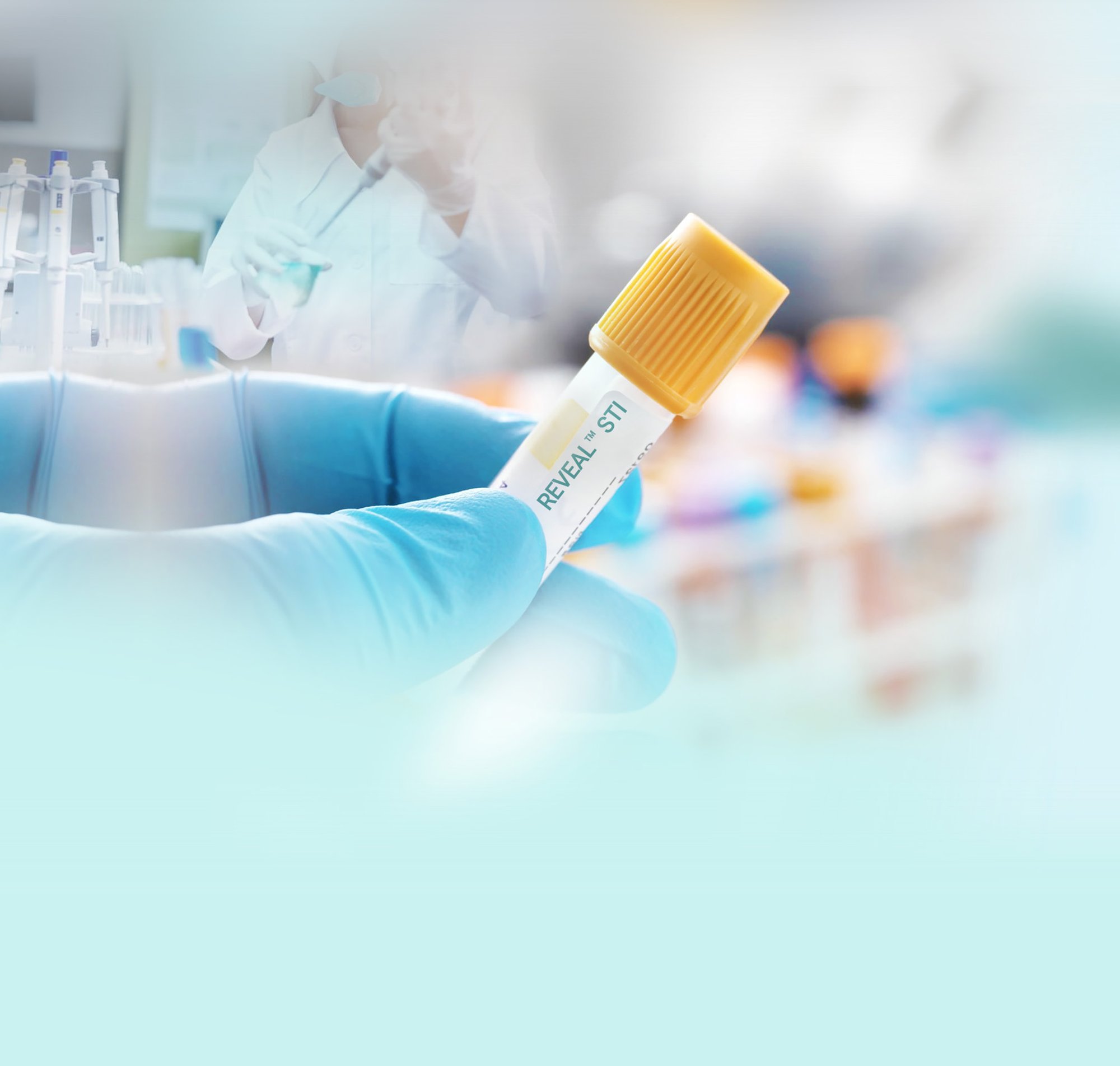 STI Testing | Infectious Disease Testing